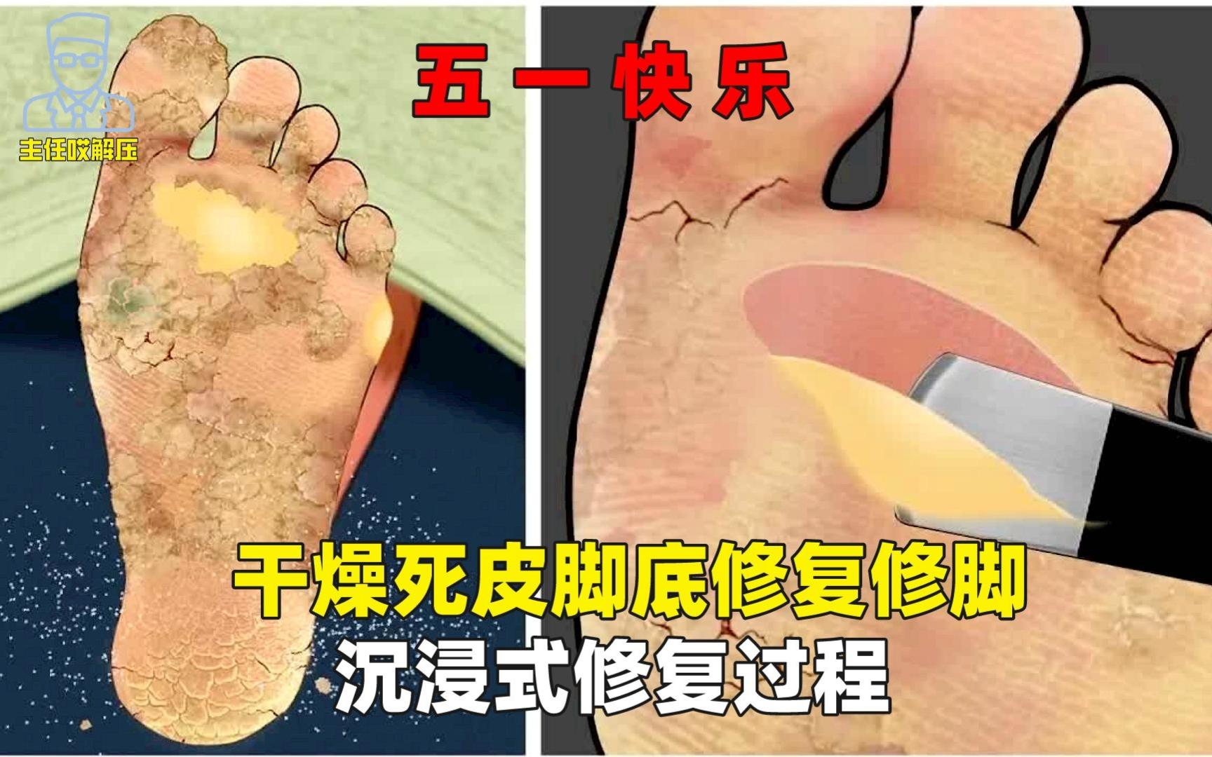 解压动画,五一快乐,干燥死皮脚底修复修脚,沉浸式修复过程