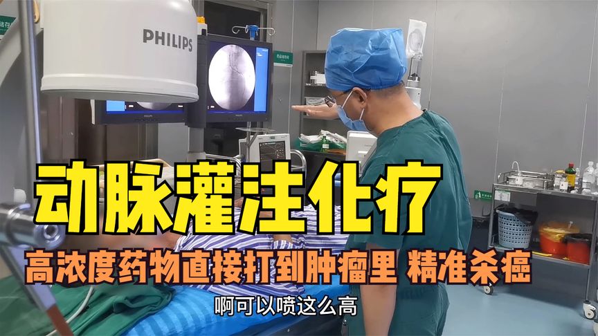 动脉灌注化疗:药物直接打到肿瘤里,精准杀癌!术后6小时最关键