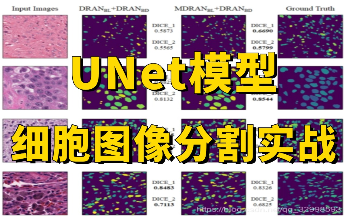 医学图像分割实战教程:基于UNet模型实现细胞图像分割,原理详解+...