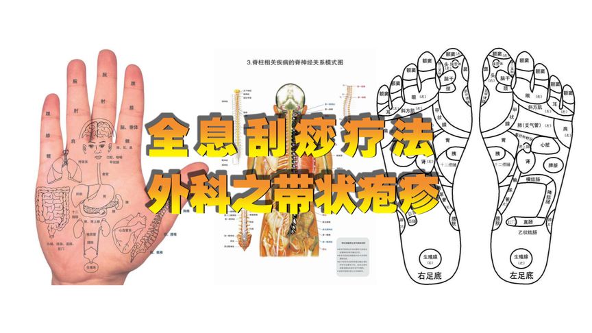 30全息刮痧疗法之带状疱疹