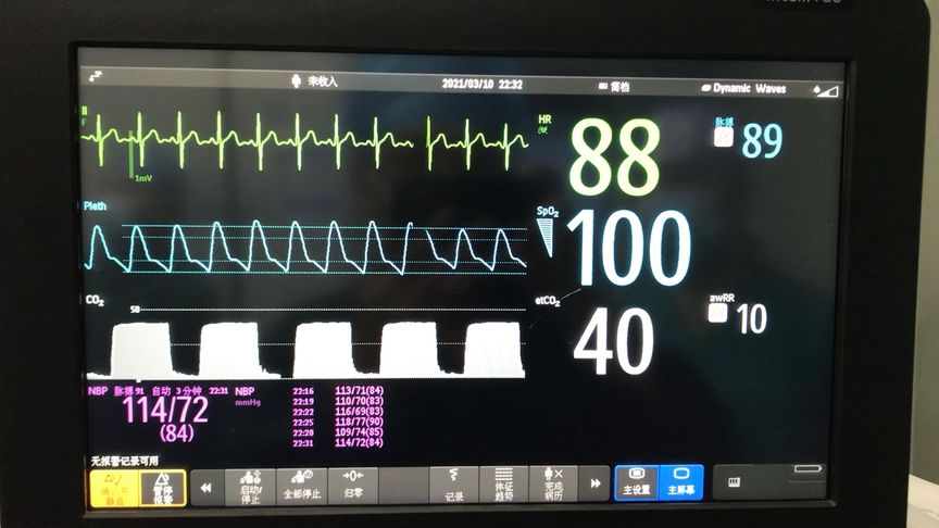 【气管插管全身麻醉中监护】知道各项指标数据和波形代表什么吗?