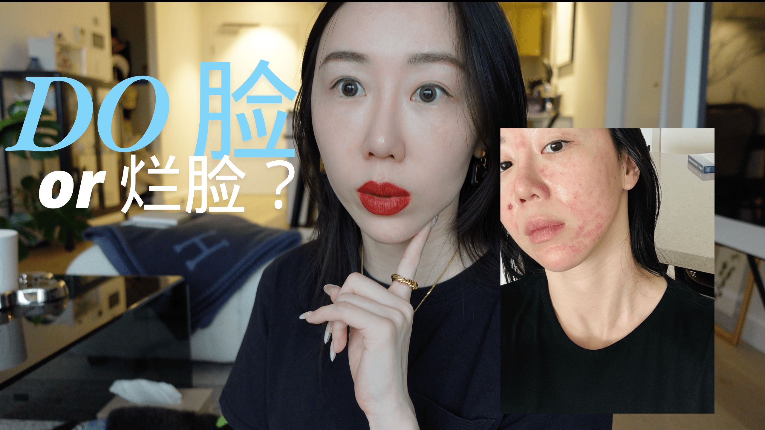 DO脸日记|医美超皮秒全过程 - 关于激光祛斑没人会说的那些事儿|黄...