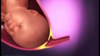 宝宝是如何出生的?3D动画模拟宝宝出生全过程