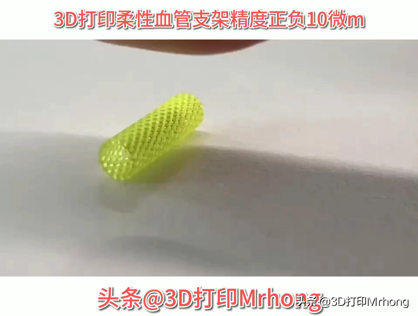 3D打印柔性血管支架精度正负10微m#医学3d打印#