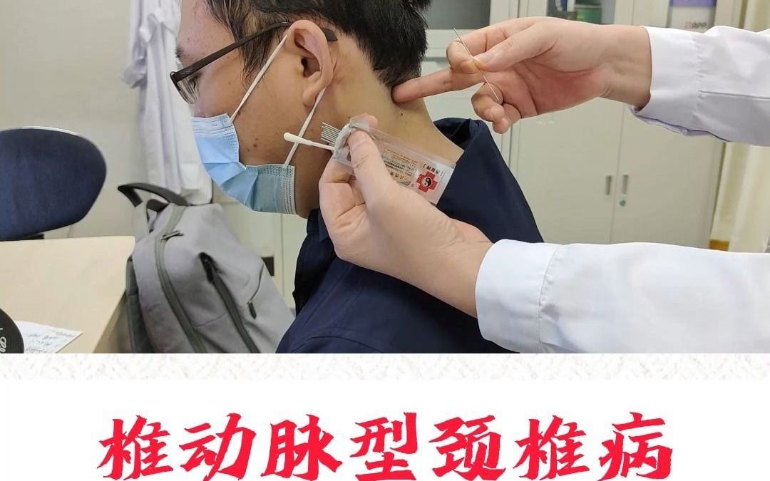 椎动脉型颈椎病——天牖穴,效果佳!温馨提示:非专业人士勿尝试