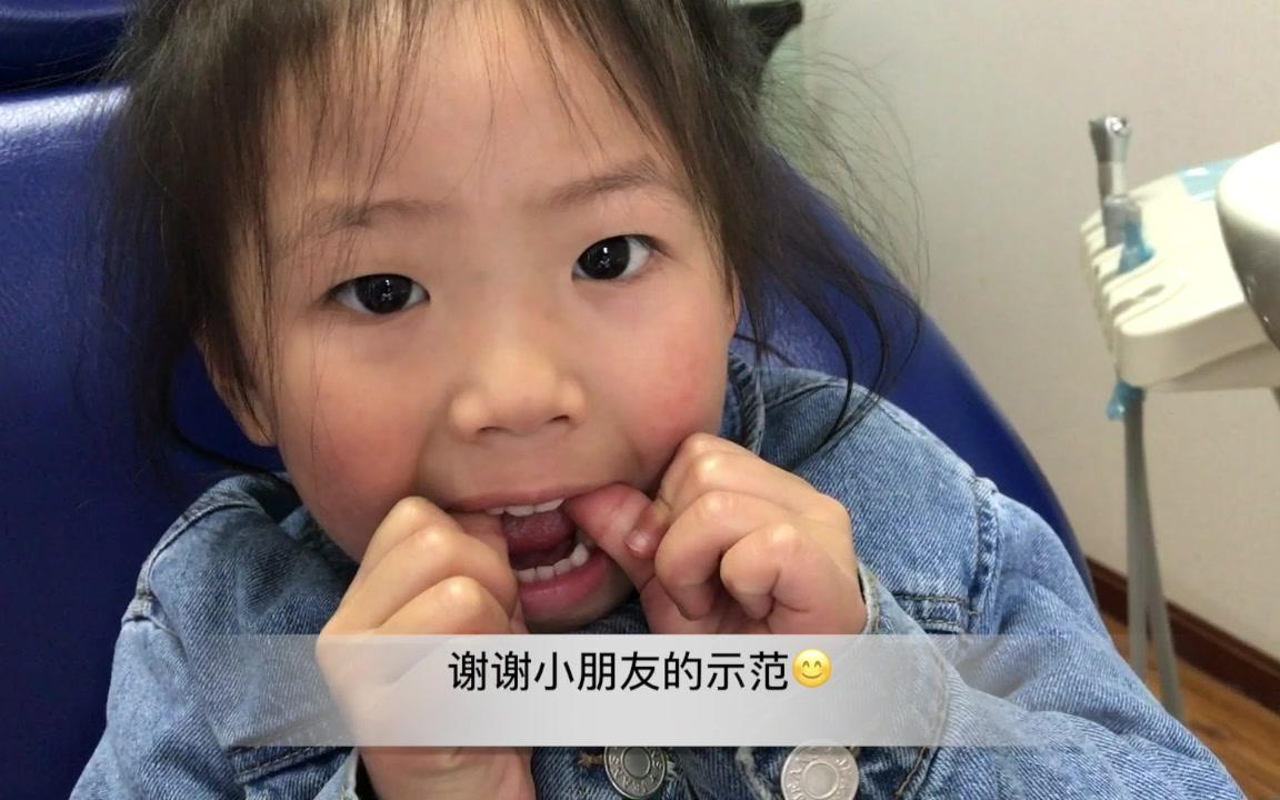 4岁小朋友示范活动矫治器的取戴