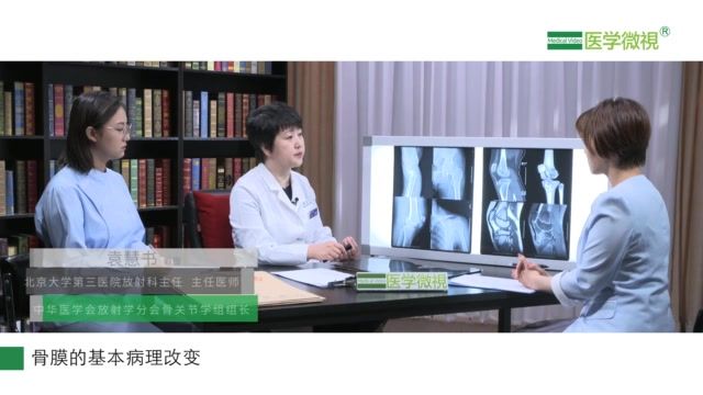 骨折后影像学检查可见骨痂形成、骨折线模糊是什么意思?
