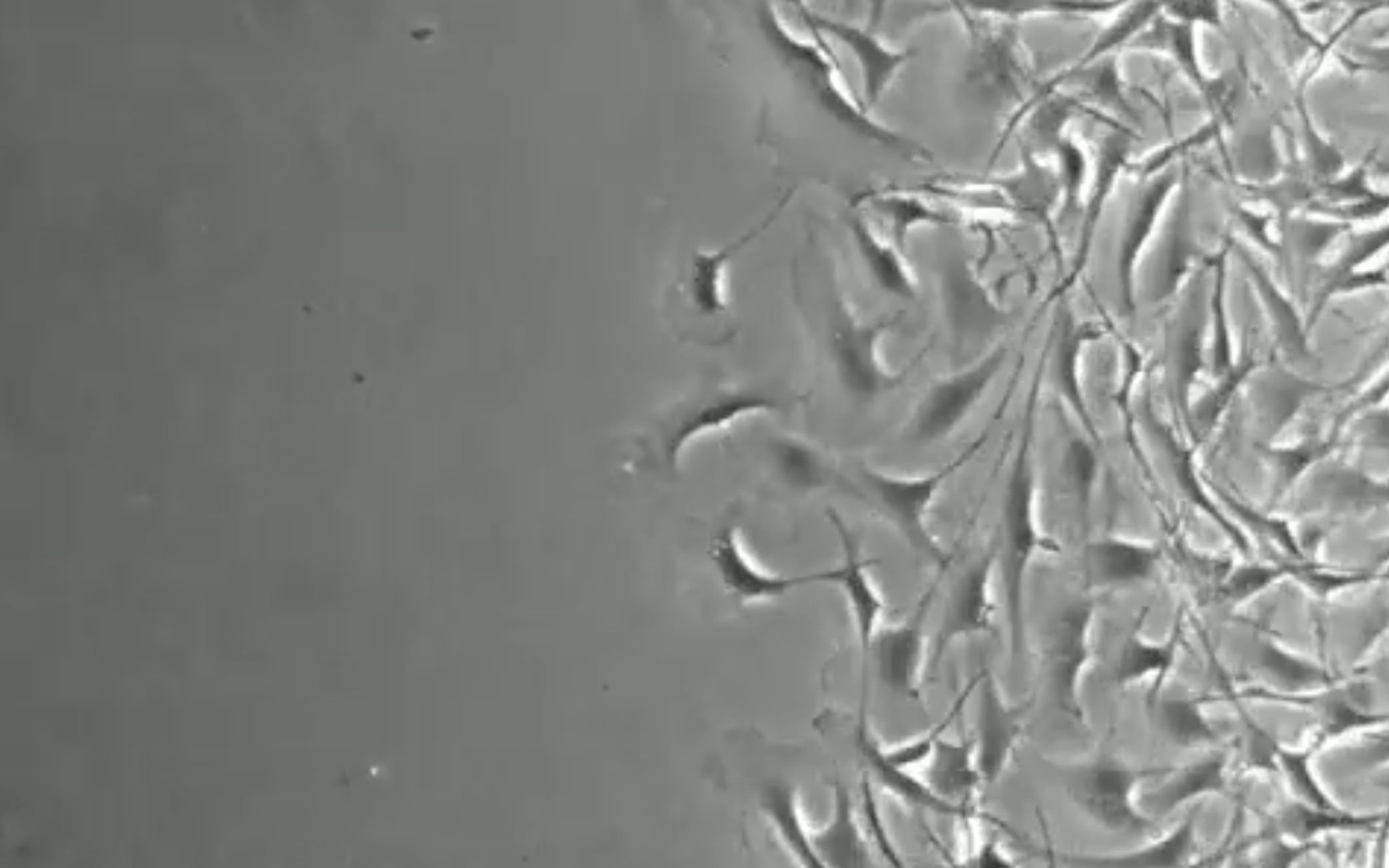 显微镜下成纤维细胞的迁移