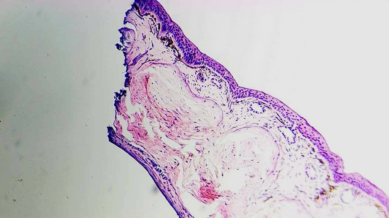 蛙的红细胞无丝分裂