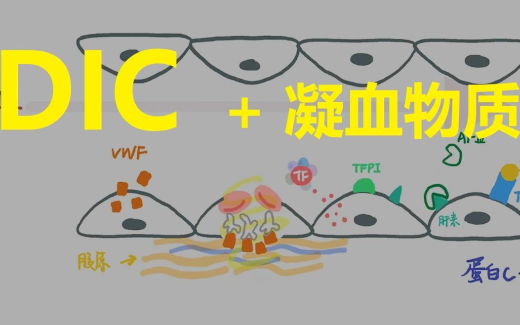 【病生三分钟】DIC:孕妇/感染DIC是什么?促凝/抗凝物质有哪些?组织...