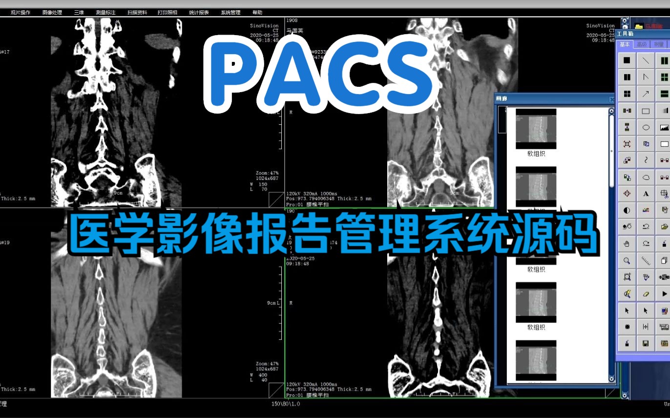 PACS医学影像报告管理系统源码