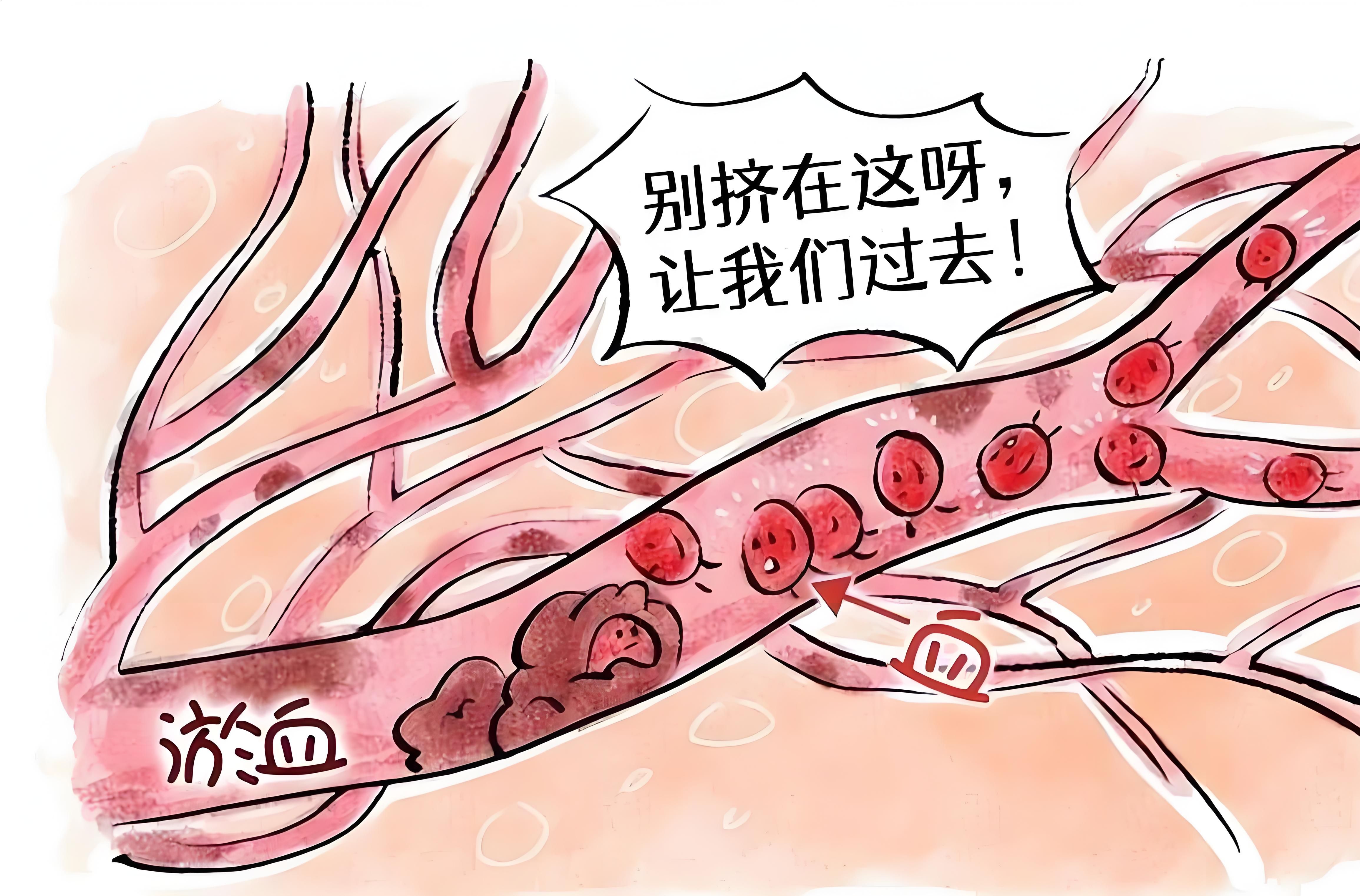 第83节:瘀血是怎样形成的