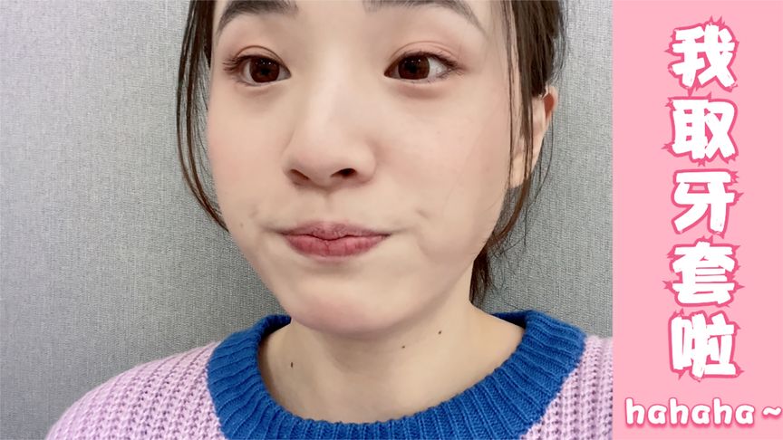 我终于摘掉了钢丝牙套:历时近三年 箍牙前后变化大吗?