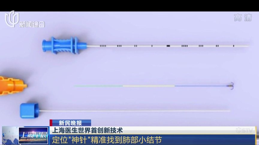 首创新技术!定位“神针”精准找到肺部小结节,成功率高达100%