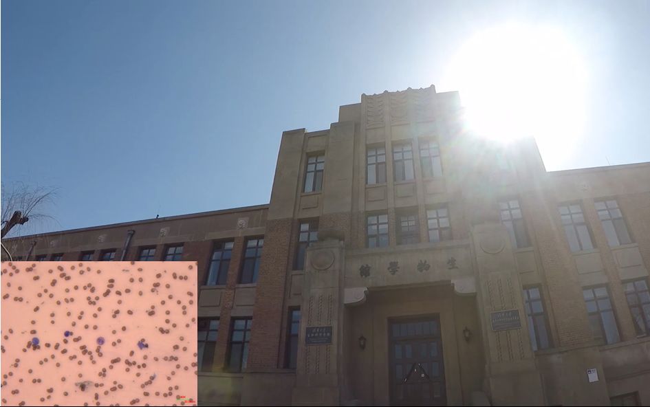 [Jersay] 清华大一的普通生物学实验怎样的?--血细胞的观察和计数