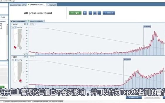 皮肤灌注压力 (SPP) 测试在临床科研的应用