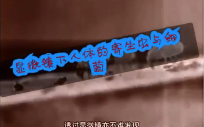 显微镜下人体皮肤上的寄生虫与细菌