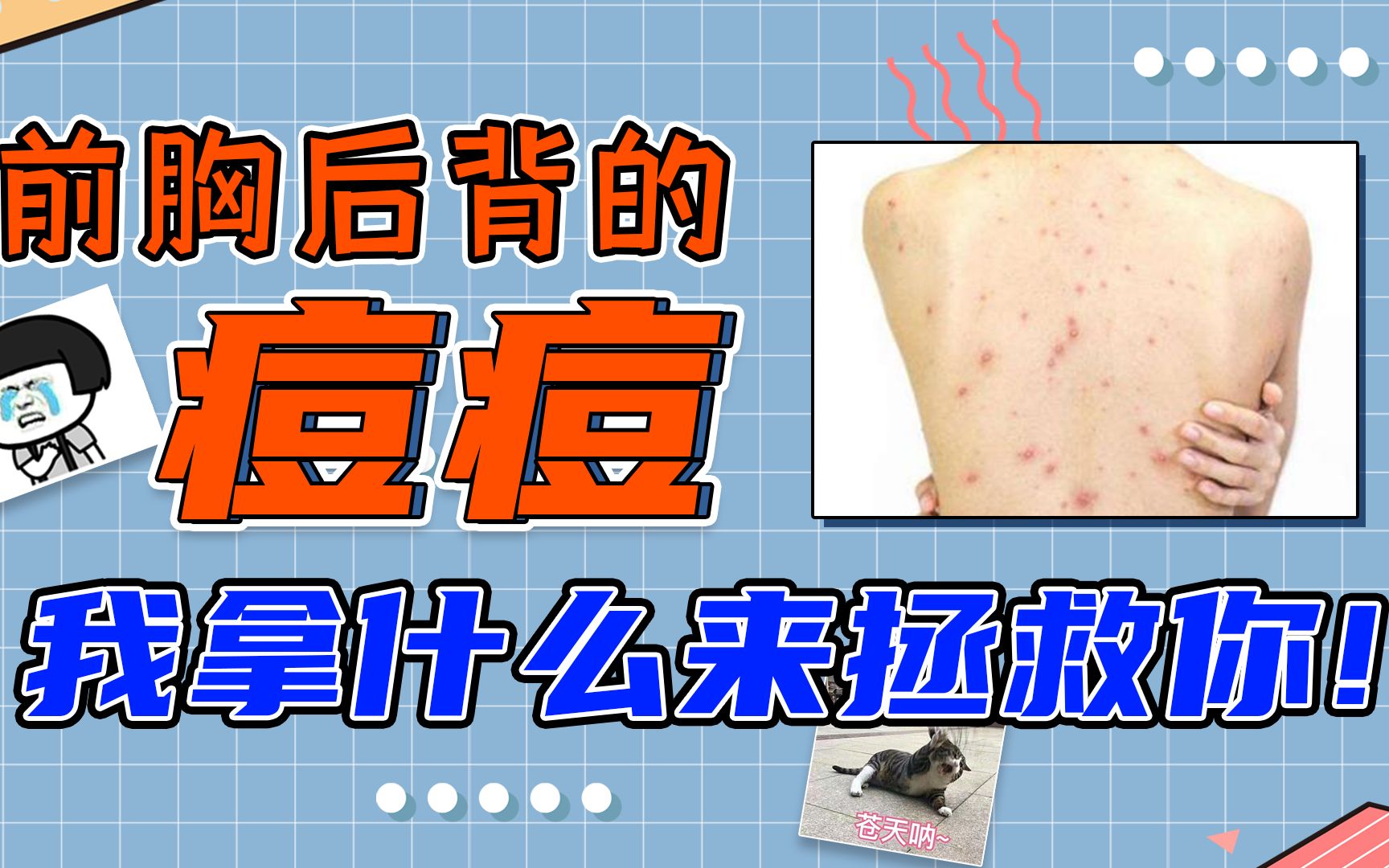 青春痘就是寻常痤疮,那长了青春痘咋办呢?