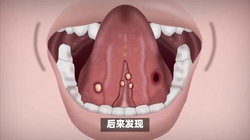 维生素B2长期吃有副作用吗?医生揭秘真实功效与禁忌