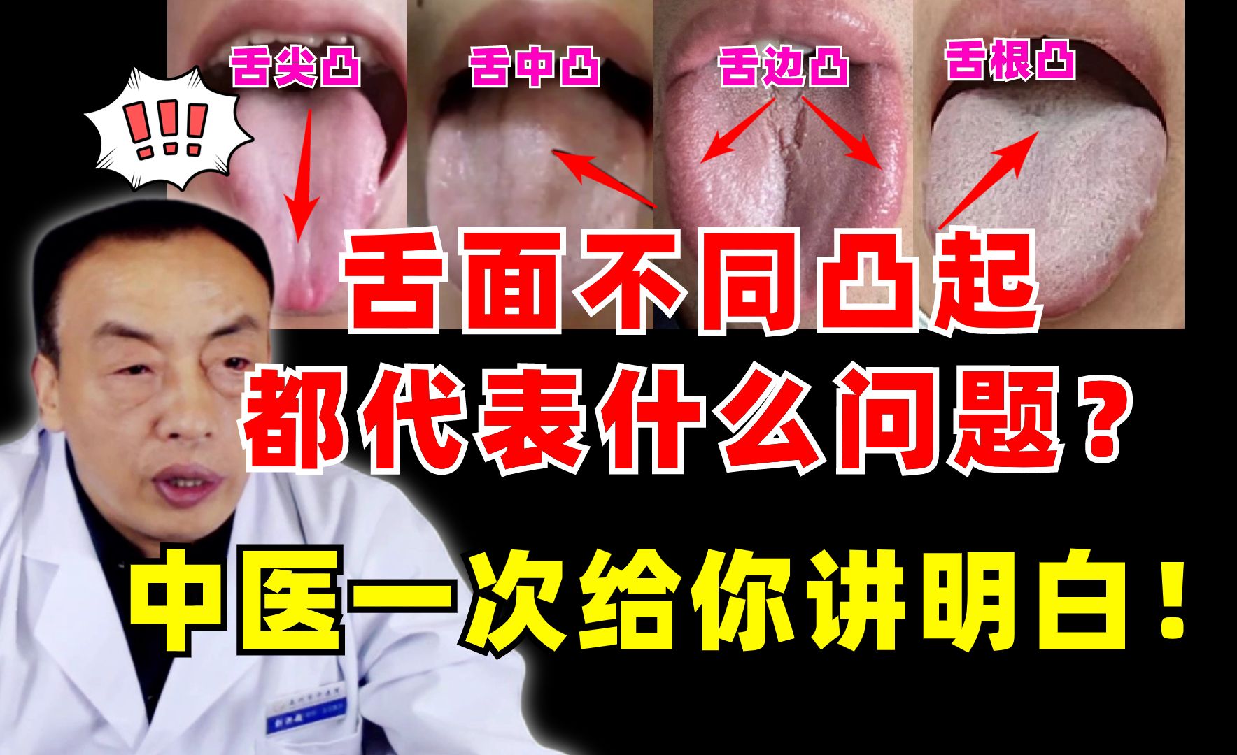 舌面凸起,凸起的位置不同,问题也不同,老中医一次给你讲明白!