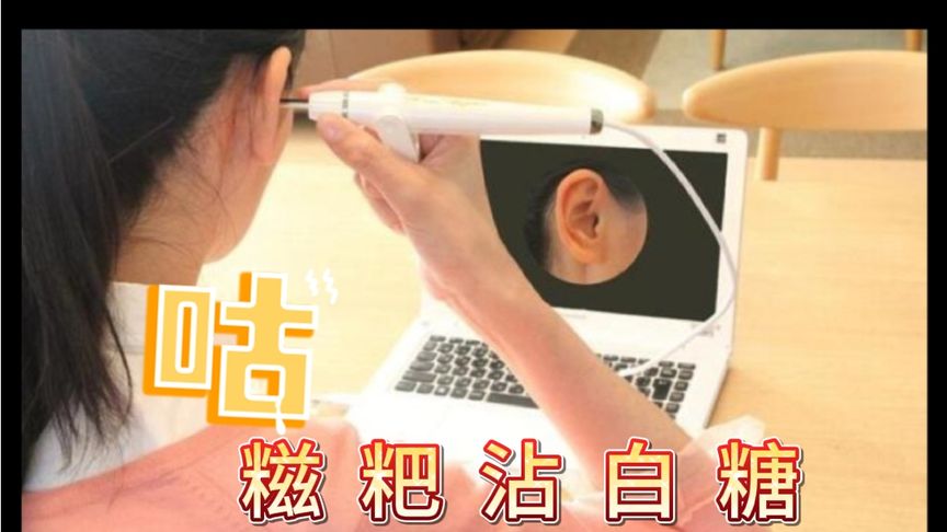 可视采耳——真菌感染导致中耳炎、耳膜穿孔