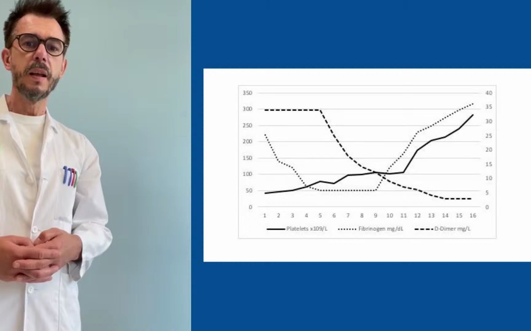 ChAdOx1疫苗接种病例中发现的血栓形成和血小板减少|Lancet