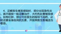 邯郸手足癣在线咨询_邯郸燕赵皮肤病医院
