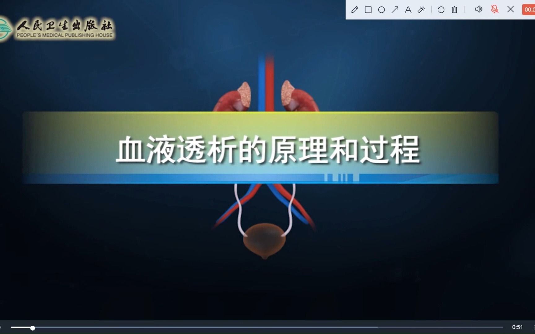 【学习自用】血液透析原理及过程