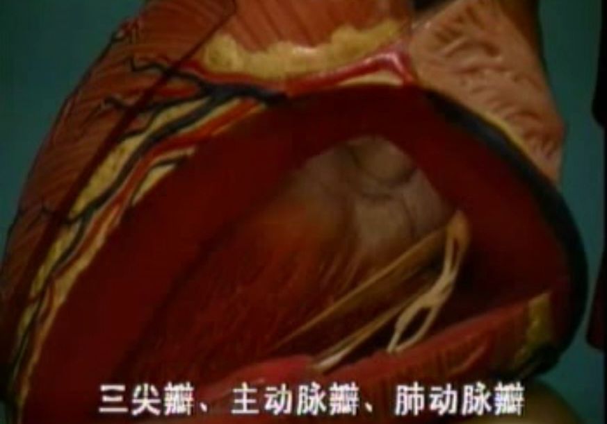 心脏瓣膜置换术