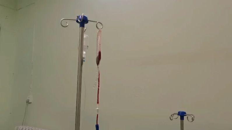 我在做三氧大自血疗法,治疗心梗