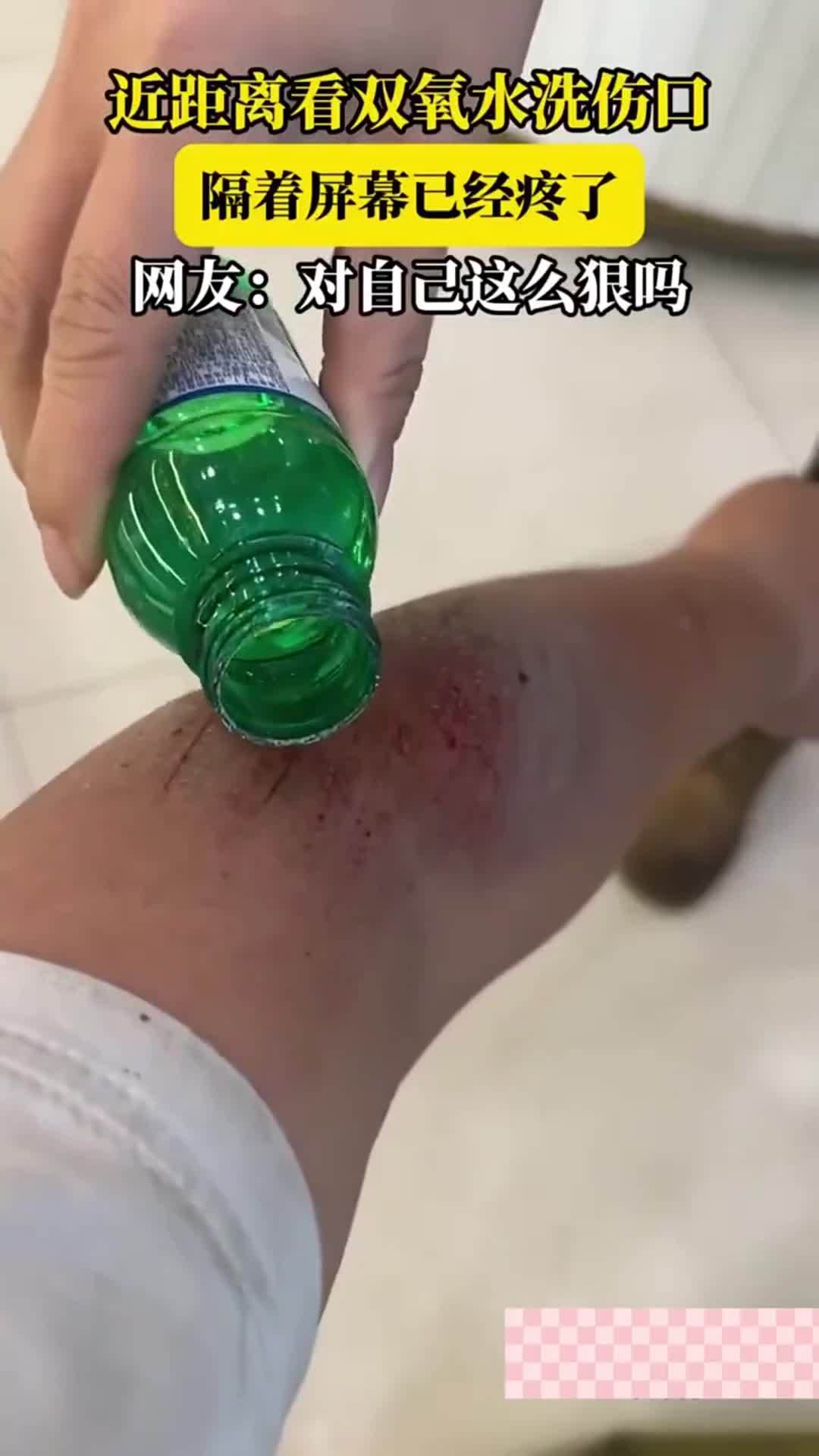 近距离看双氧水洗伤口,隔着屏幕都疼,网友:对自己这么狠?