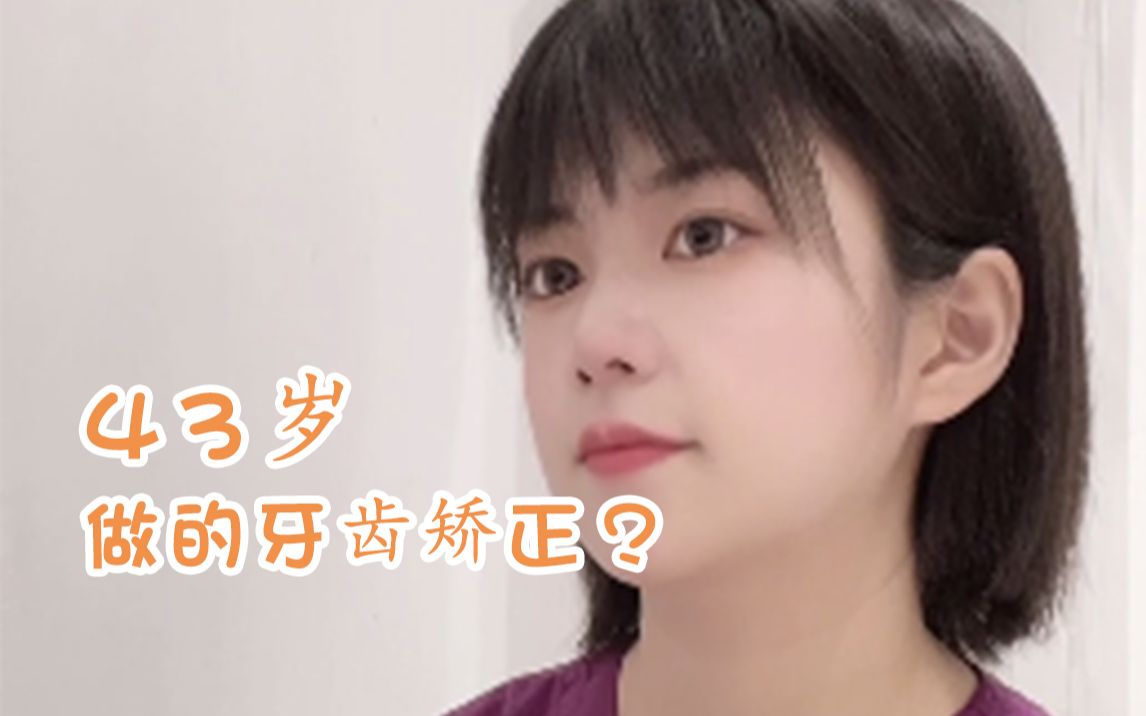 43岁了也能做牙齿矫正?