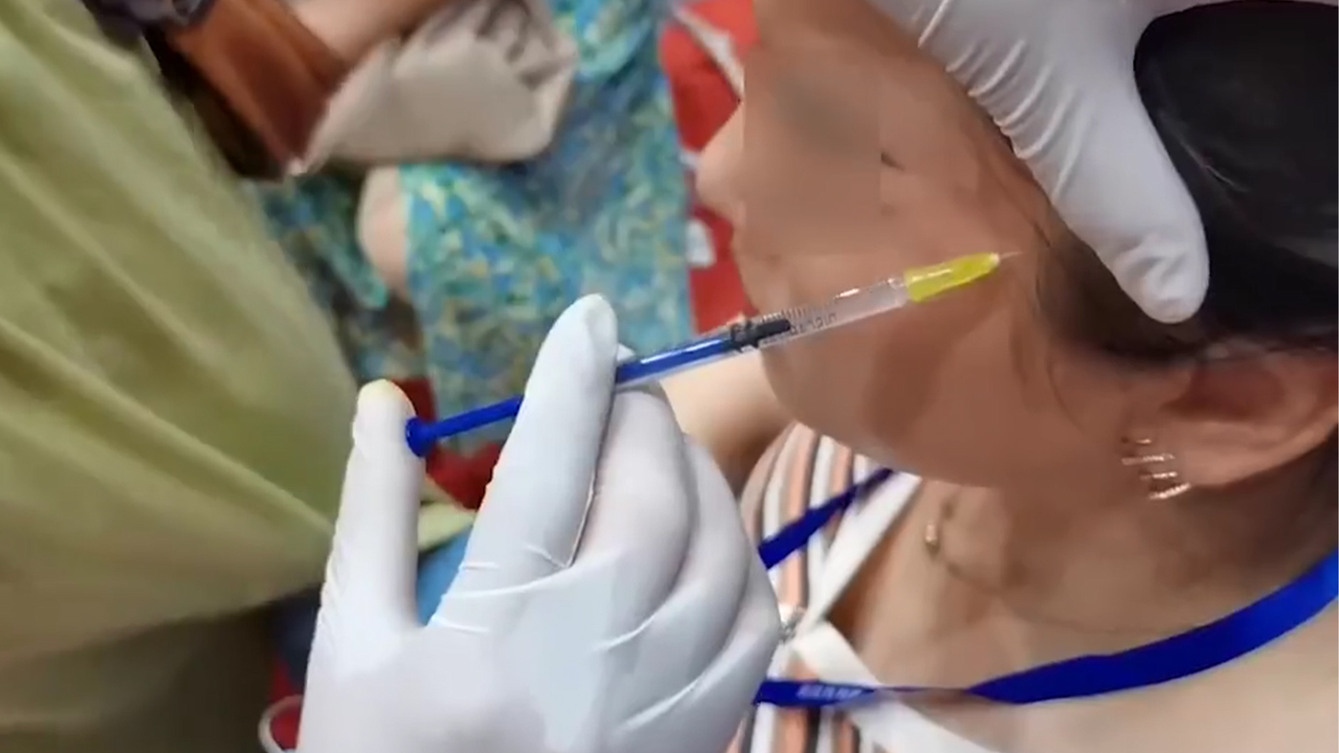 美容不成小心毁容!3·15晚会曝光不可注射的美容针