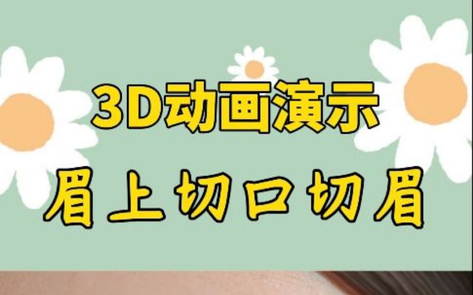 3D动画演示:眉上切口提眉!