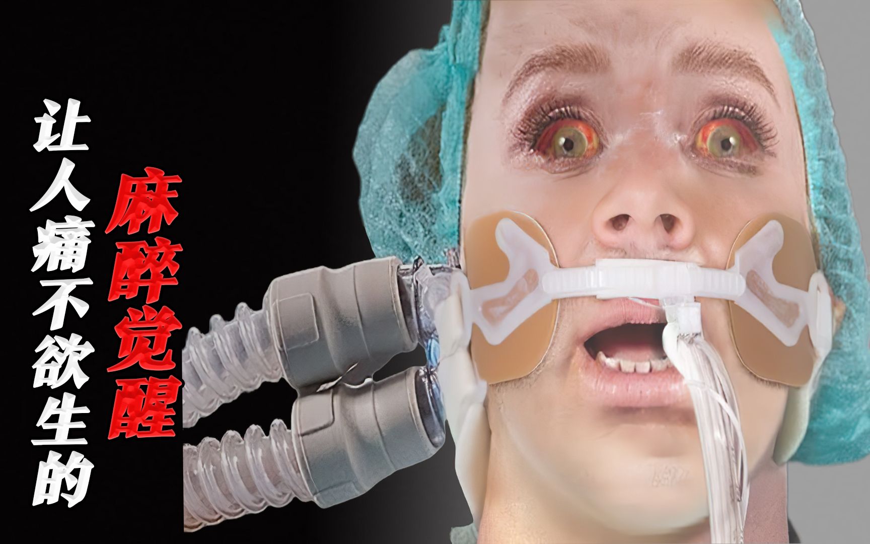 明明是全身麻醉,却要体验手术全过程,麻醉觉醒究竟有多可怕?