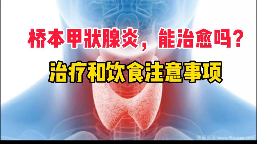 桥本甲状腺炎,能治愈吗?治疗和饮食注意事项