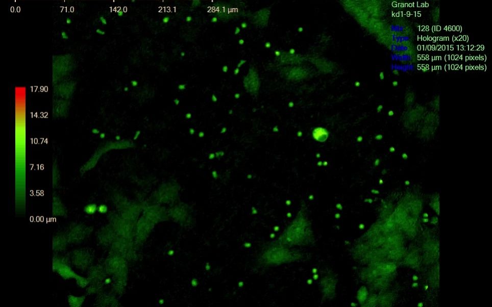 肿瘤环境中中性粒细胞对癌细胞的趋化作用 | HoloMonitor M4 活细胞...