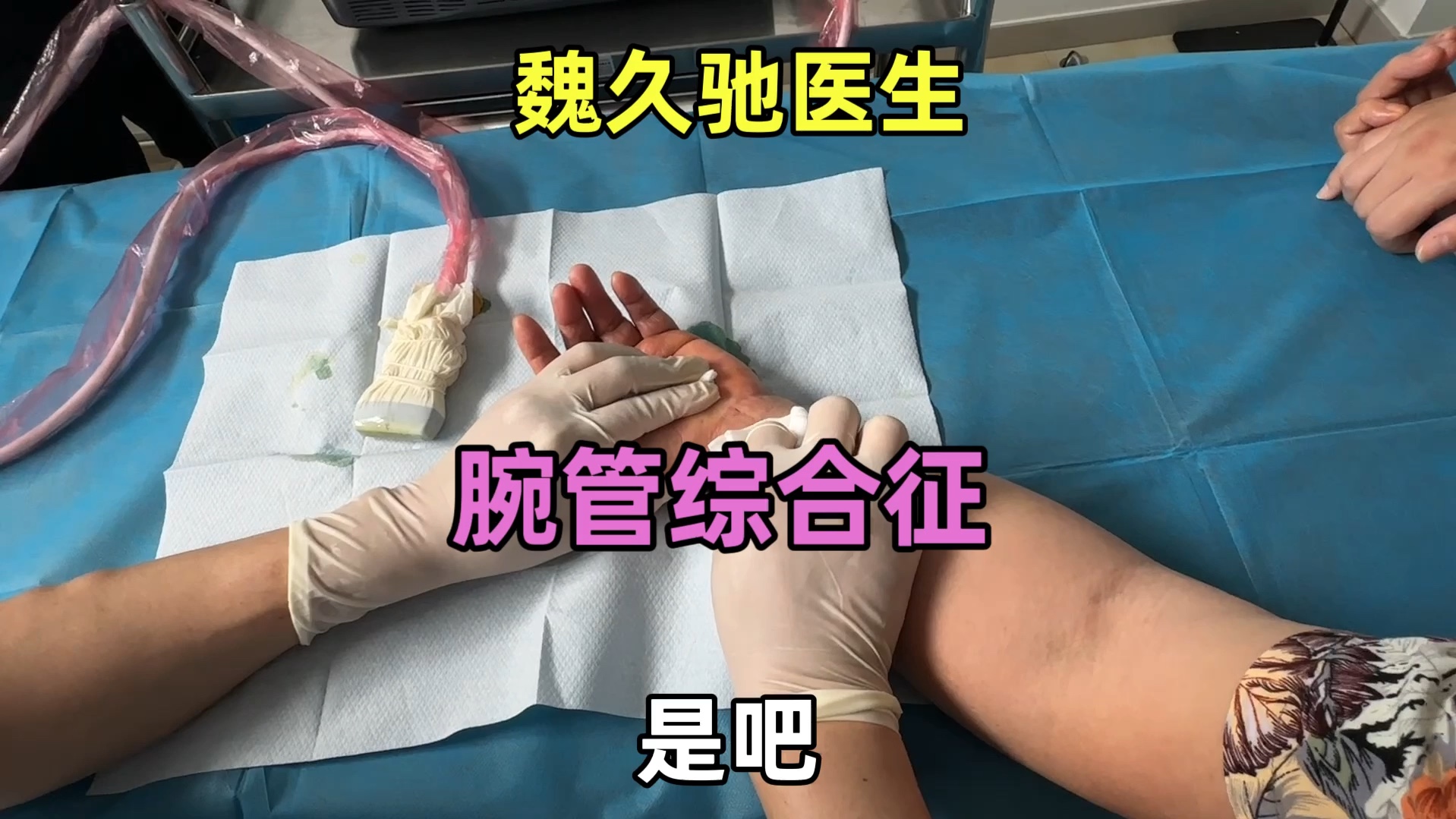 腕管综合征微创手术:一刀开鞘术,不留疤痕,随治随走,一刀医疗
