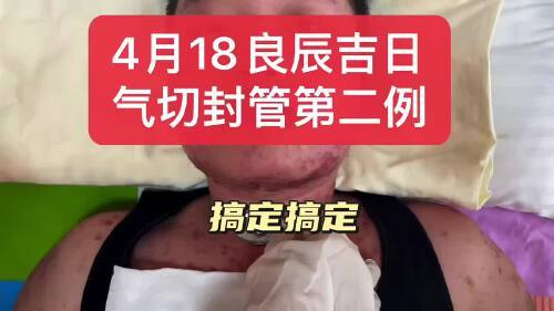 皮肤护理 皮肤疾病,自身免疫性脑炎,气切封管成功