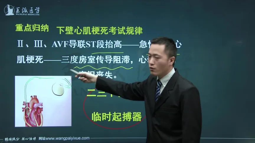 2020王派医学临床医师心血管记忆点睛-心肌梗死心电图定位和临床