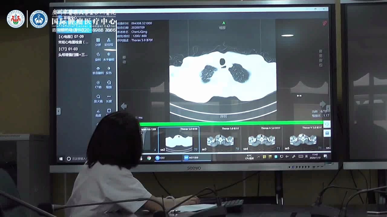 构建多学科协作机制,建设科学、规范、先进的肿瘤治疗体系