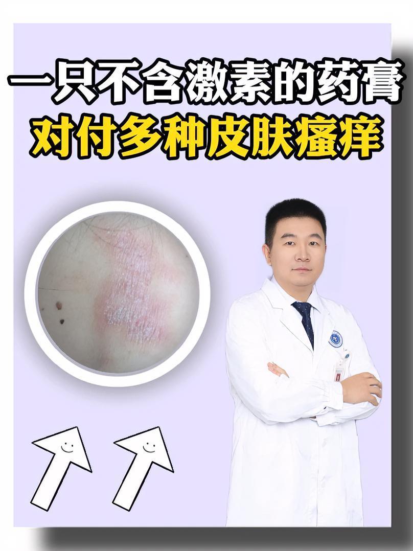 .的药膏,能对付多种皮肤瘙痒问题 皮肤瘙痒 湿疹 神经性皮炎 肛周湿疹