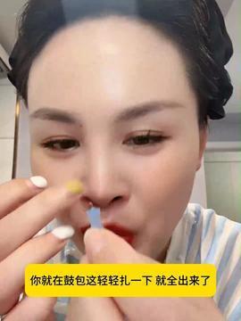 真的好解压呀#次抛清洁工具 #自用好物推荐 #一次性粉刺针 #种草