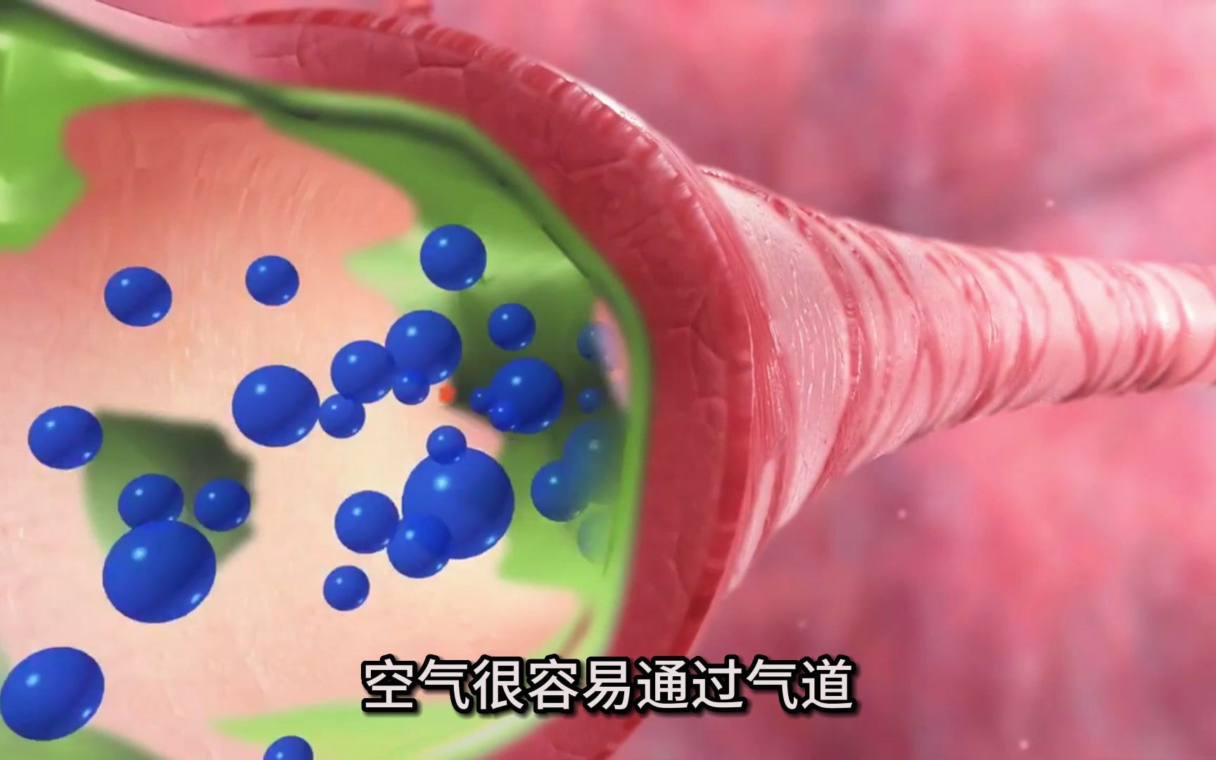 哮喘气道3D动画