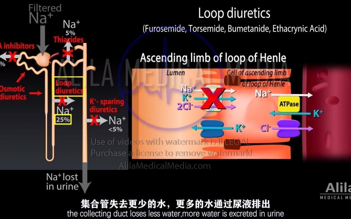 【Alila Medical Media】47.不同利尿剂的作用机制