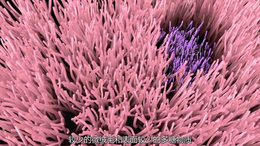 一个超高清的动画视频,告诉你人是怎么得上痢疾的
