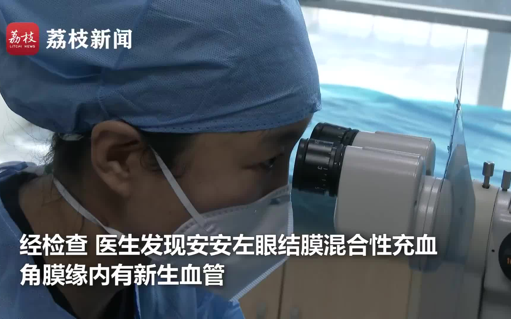 不许挑食!9岁女童不吃蔬菜缺乏核黄素,致束状角膜炎