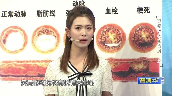 脑血管堵塞怎么办?医生告诉你血管通畅自如