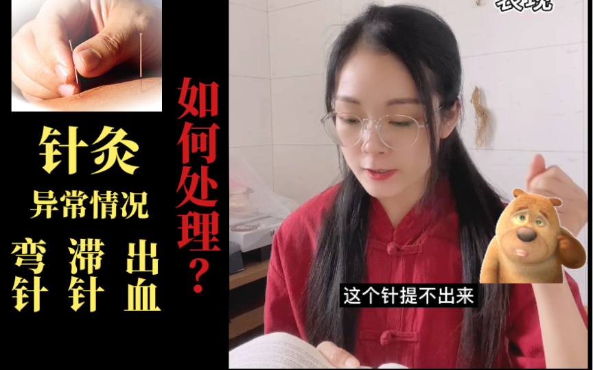 针灸时出血了、扎肿了、针弯了、针拔不动了…新手必学:针灸中异常...