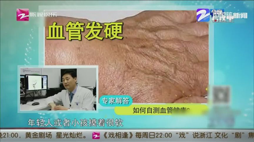 如何检测脑血管出毛病:手上的青筋较硬可能有动脉硬化的风险